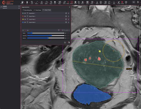 dicom metadata extraction a comprehensive guide for medical imaging professionals 2024