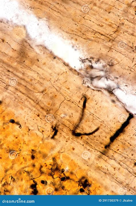 Cerebellar Cortex Parallel Fibers Stock Image Image Of Neuroscience Layer