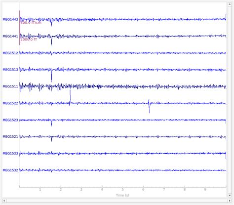 Plot Sensor Denoising Using Oversampled Temporal Projection — Mne 171