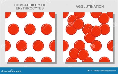 Agglutination Cartoons Illustrations And Vector Stock Images 40