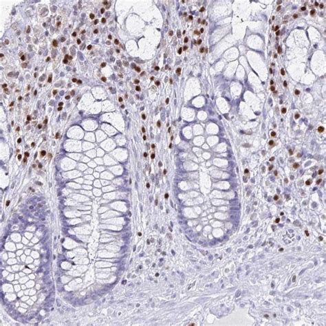 Runx2 Antibody Pa5 82787