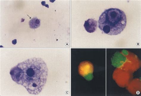 Microscopic Morphology Of Fused Cell Between Cultured Dendritic Cells