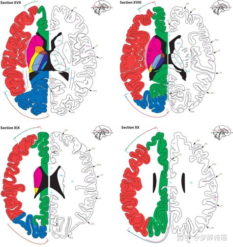 脉络膜前动脉（acha） 脑血管解剖 知乎