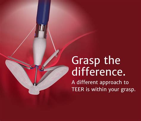 The Pascal Precision System Edwards Lifesciences