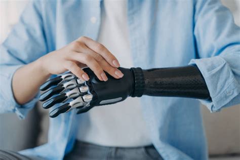 bionic arm prosthetics