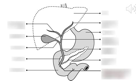 Gallstone Disease Biliary Colic Cholecystitis Ascending Cholangitis