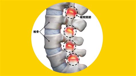 腰痛について：腰痛の種類① Personal Body Management株式会社