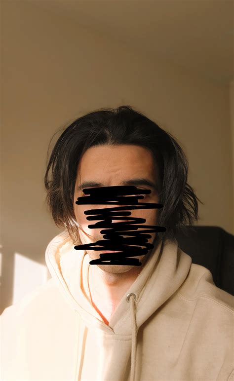 Am I Thinning Balding R Malehairadvice