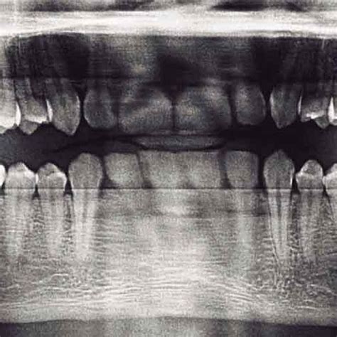 An OPT Image Of An Adult Female Note That Deepest Flexure Point On Download Scientific Diagram