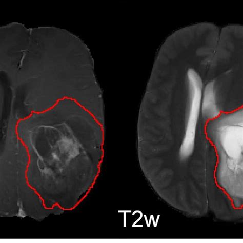 Example Of The Segmentation Result Download Scientific Diagram
