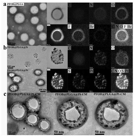 Bionic Drug Loading Nano System Combining Cell Membrane Antagonism With Nano Enzyme Preparation