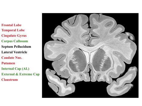 PPT Cortex Cingulate Gyrus Precentral Gyrus Postcentral Gyrus Primary Visual Cortex
