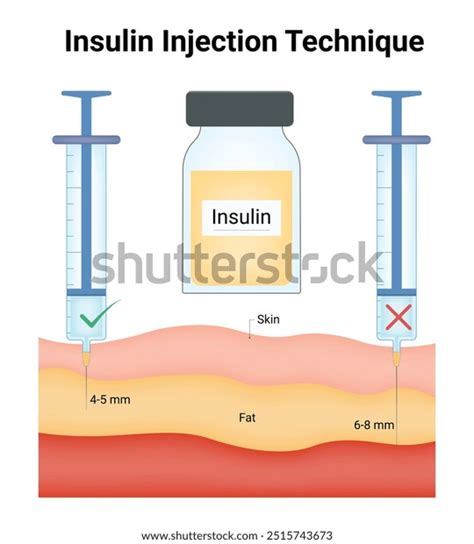 Insulin Injection Technique Science Design Vector Stock Vector Royalty Free 2515743673