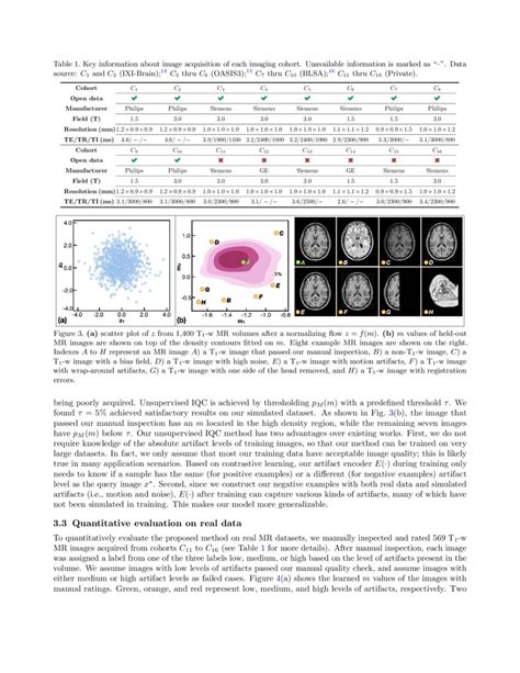 A Latent Space For Unsupervised Mr Image Quality Control Via Artifact