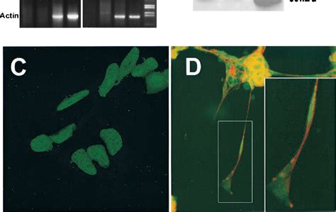 Figure From FragmentReceptor For The C A Complement Activation Neuronal Expression Of A