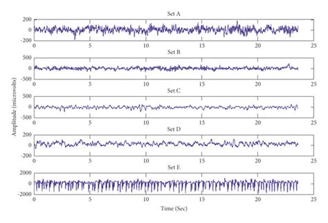 Sample EEG Signals From Datasets A To E Download Scientific Diagram