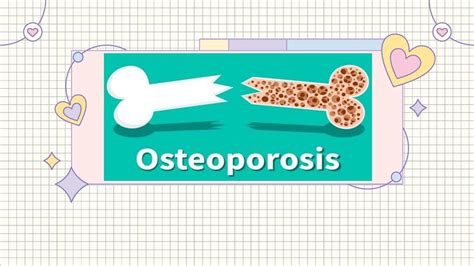 Osteoporosis META UDocz