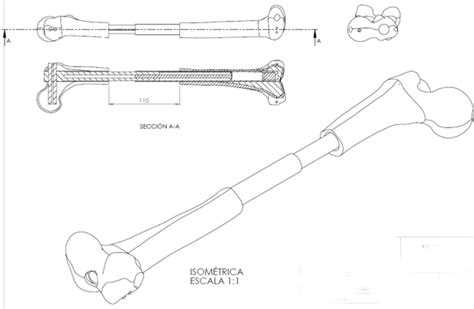 Self Supporting And Autonomous Prosthesis For The Progressive Lengthening Of Long Bones