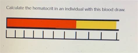 Solved Calculate The Hematocrit In An Individual With This