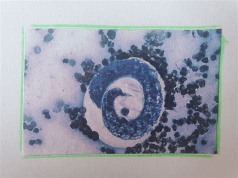 Nematode Matching Flashcards Quizlet