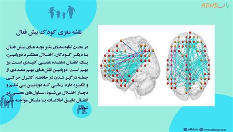 هیجان‌انگیز نگاهی نو به مغز افراد بیش فعال