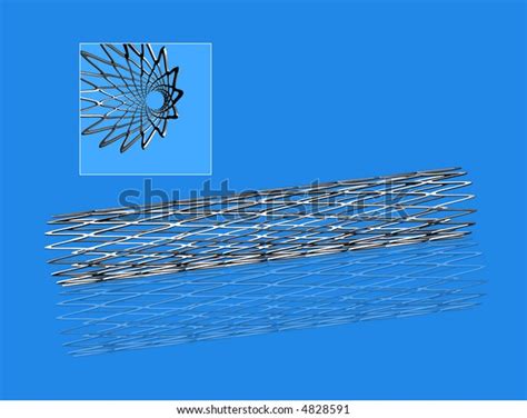 1 Coronary Artery Bypass Multiple Royalty Free Photos And Stock Images 1 Coronary Artery Bypass Multiple Royalty Free Photos And Stock Images
