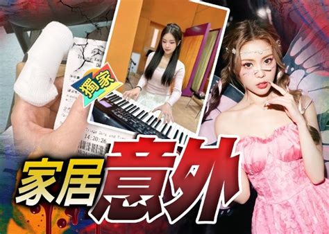 黃瀅仴綵排缺席揭遇家居意外 鐵線篤穿手飛奔急症室｜即時新聞｜繽fun星網｜oncc東網