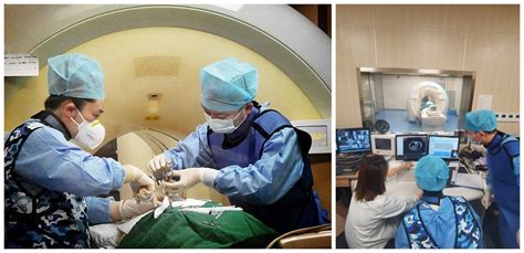 上海九院专家团队成功为小细胞肺癌晚期患者实施肿瘤“定点爆破” 治疗 粒子 放射性