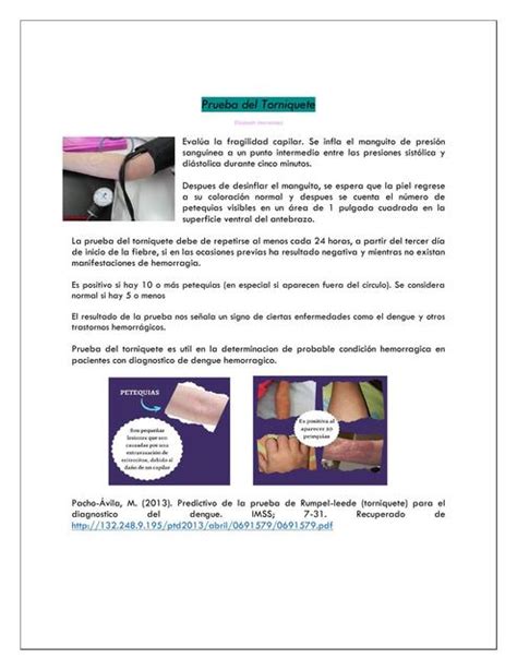 Prueba Del Torniquete Elizabeth Hernández Udocz