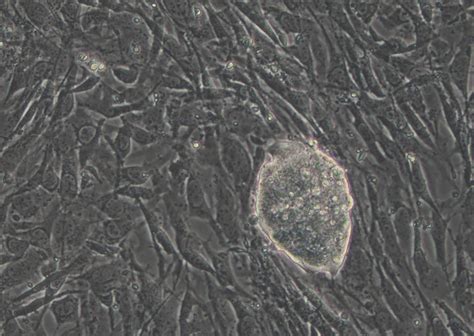 Why I Can Not Survive Mouse Ipscs After Picking Up Researchgate