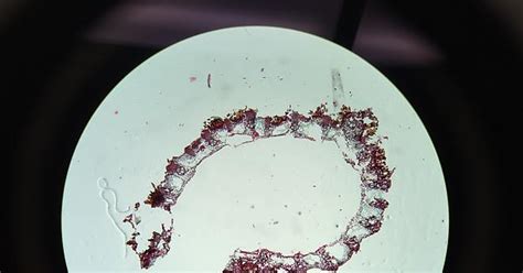 Wheat Rust Pathogen Life Cycle Album On Imgur
