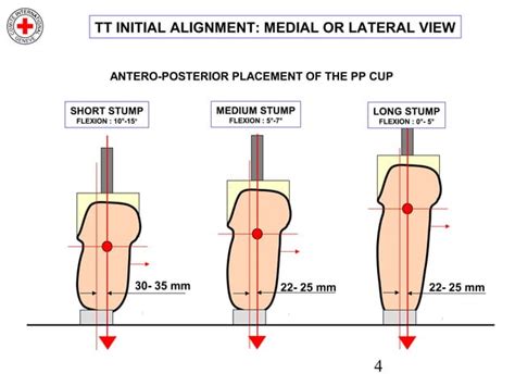 Transtibial Initial Alignment PPT