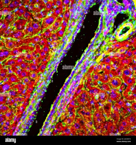 Liver Triad Fluorescence Deconvolution Micrograph Of A Section Through Liver Tissue Showing A