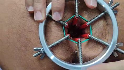 Anal Expander First Steps Thisvid Com