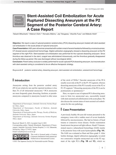 Pdf Stent Assisted Coil Embolization For Acute Ruptured Dissecting Aneurysm At The P2 Segment