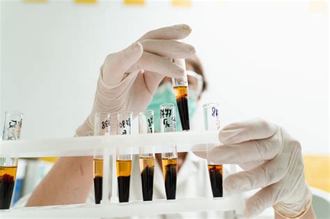 혈장 분석 실험실 조수는 손에 정맥에서 혈액이 묻은 시험관을 들고 그것을 봅니다 실험실에서 혈액 검사 안경과 마스크를 쓴 의학 과학자 45 49세에 대한 스톡 사진 및 기타