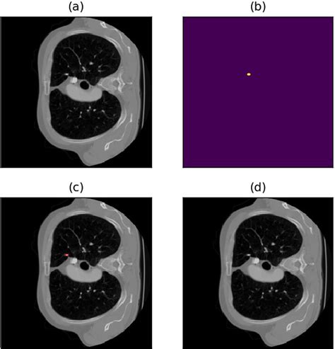 Figure 1 From Lung Nodule Segmentation Via Semi Residual Multi Resolution Neural Networks