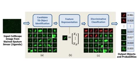 Automated Tuberculosis Diagnosis Using Fluorescence Images From A Mobile Microscope Biomedical