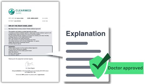 Pca Explanation