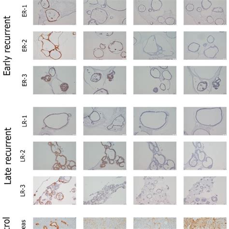 Immunohistochemistry Staining Of Pdos Paraffin Embedded Organoids Were Download Scientific