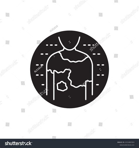 Vitiligo Color Line Icon Dermatology Disease Stock Vector Royalty Free 2151897203 Shutterstock