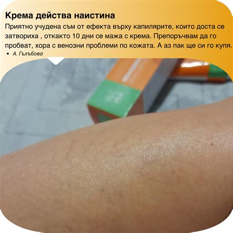 Ефикасен крем за разширени вени натурално облекчение с Inaessentials