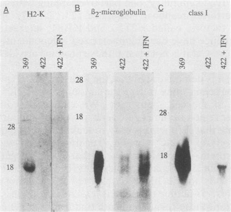 Northen Blot Analysis Of Rna From Cell Lines 369 And 422 Total