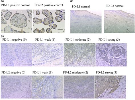 Representative Staining Patterns Of The Samples A Placenta Was