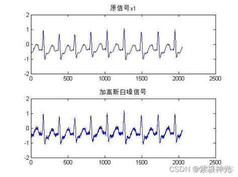 【心电信号】基于matlab心电信号特征提取分析处理【含matlab源码 289期】qq60e3e93d3591c的技术博客51cto博客