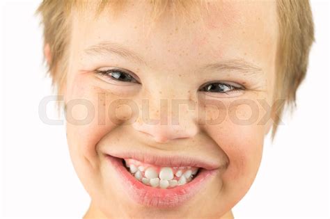 Down Syndrome Face Features Clipart
