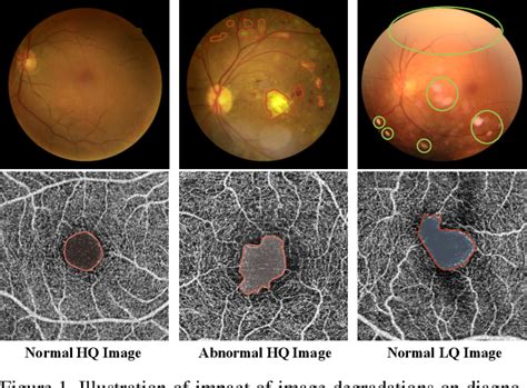 Figure 2 From Image Quality Aware Diagnosis Via Meta Knowledge Co Embedding Semantic Scholar