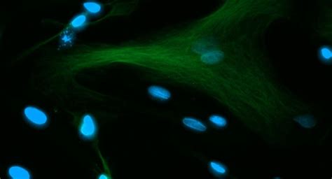 Cells Alive Gerald Bordelon Photos Murderpedia The Encyclopedia