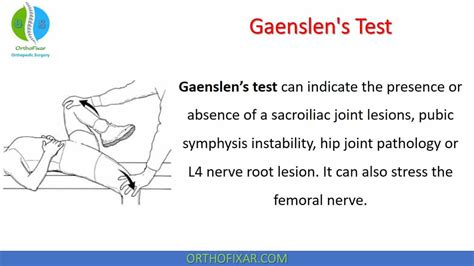 Gaenslens Test Explained Easily Orthofixar