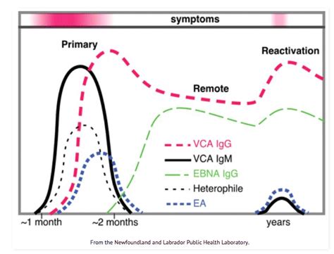 How To Diagnose And Test For Ebv Labs Markers And Results Explained